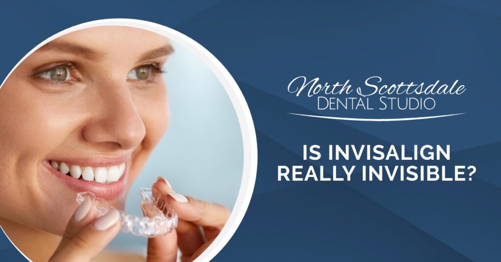 Invisalign Clear Braces Scottsdale Phoenix Az